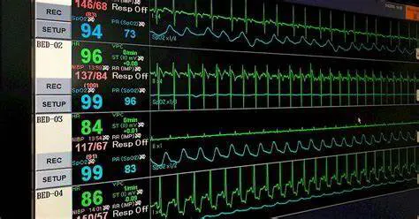 free monitor technician course