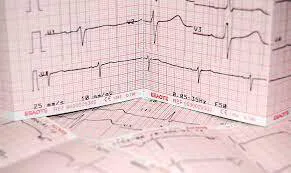 EKG-Telemetry certification
