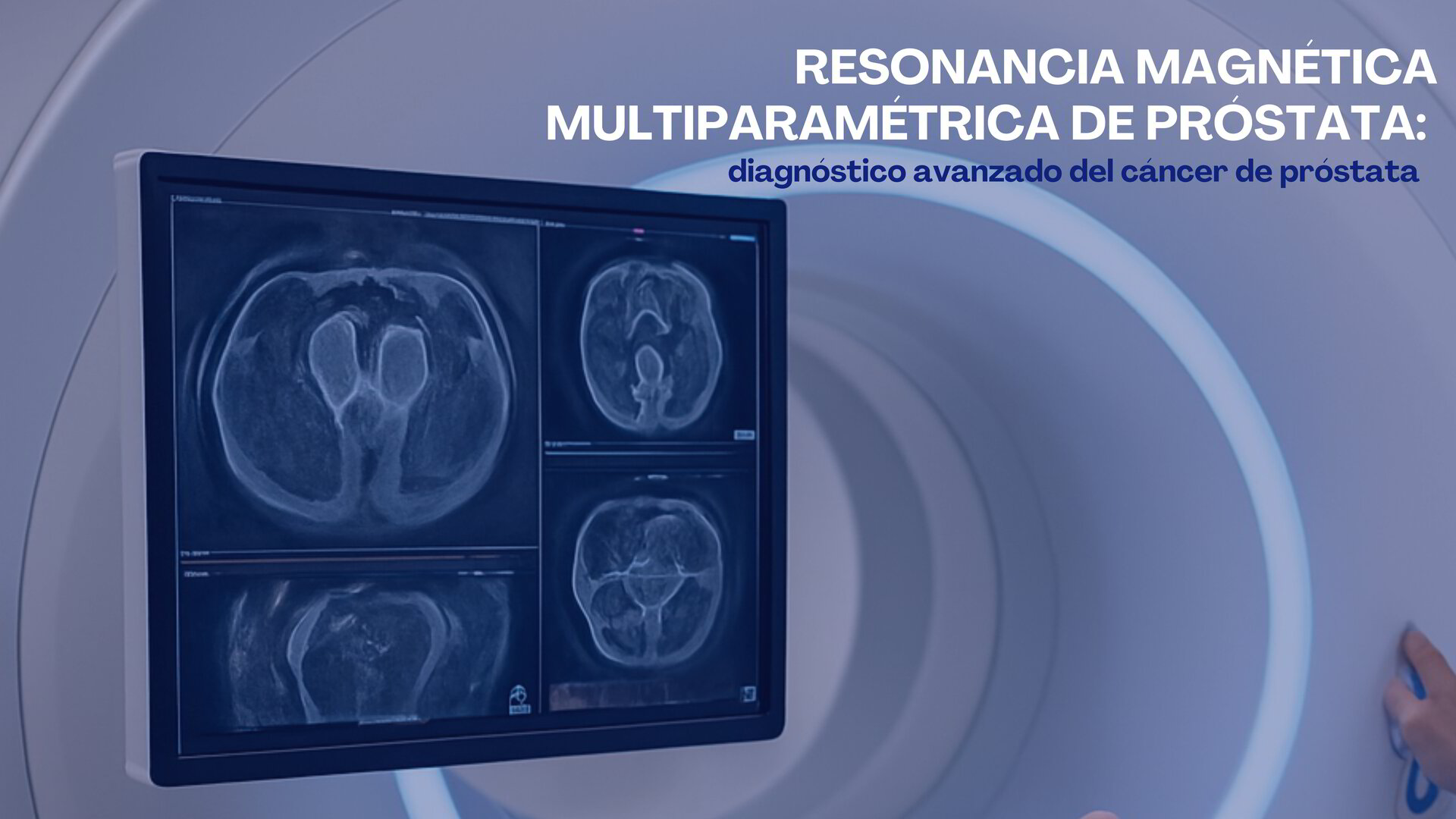 Resonancia magnética multiparamétrica de próstata: diagnóstico avanzado ...