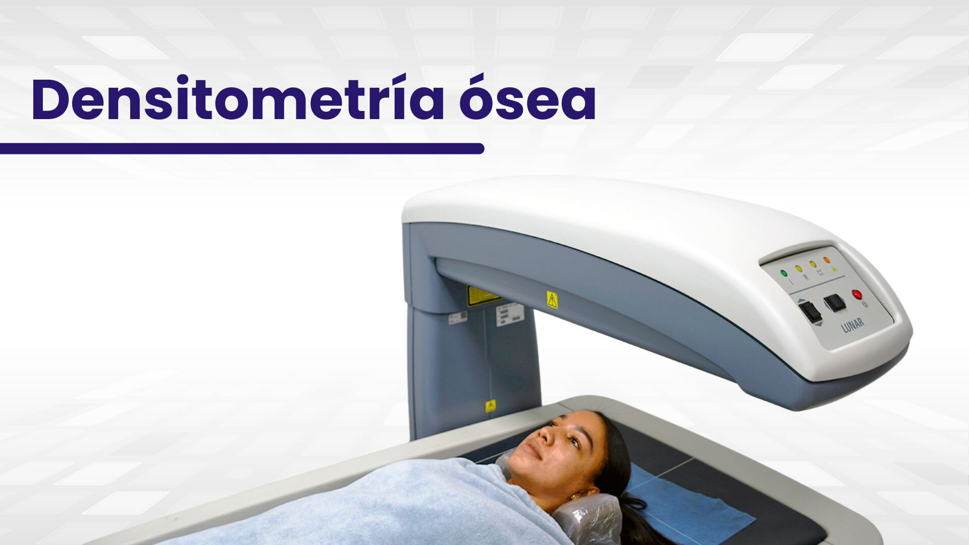 Protege tu salud ósea: descubre los beneficios de la densitometría ósea