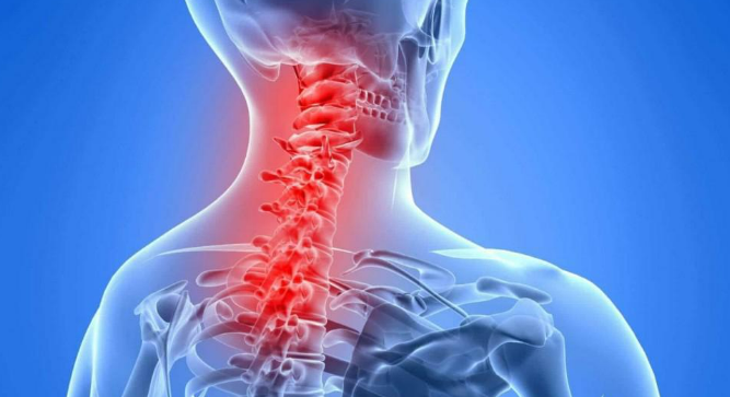 Neck pain: Cervical Facet Syndrome causes pain in-behind shoulder blades