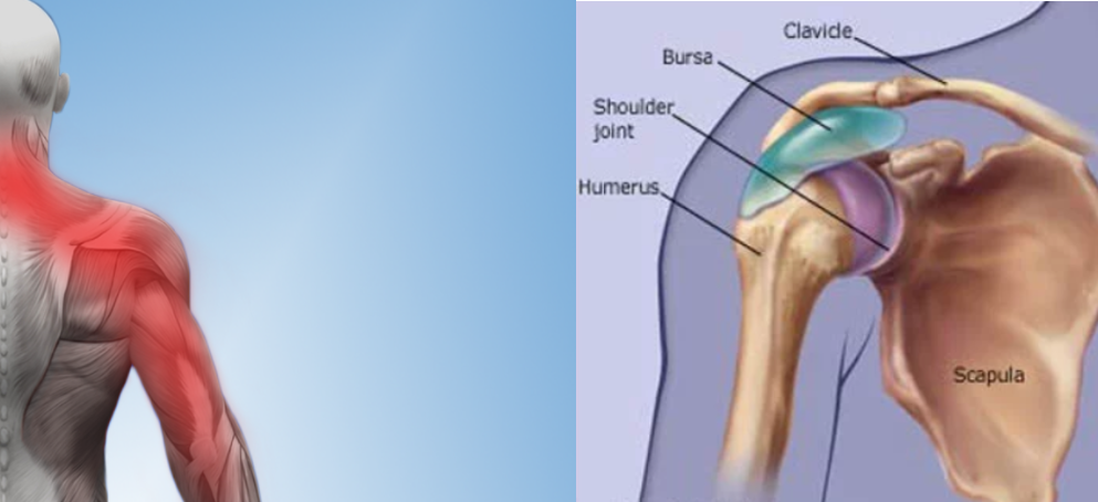 Shoulder Bursitis & Rotator Cuffs | Auckland Health & Performance