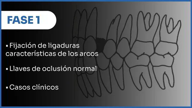 CURSO VIRTUAL CEMENTACIÓN DE BRACKETS