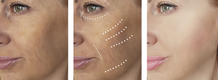 Unveiling the Truth: Symptoms and Causes of Premature Aging