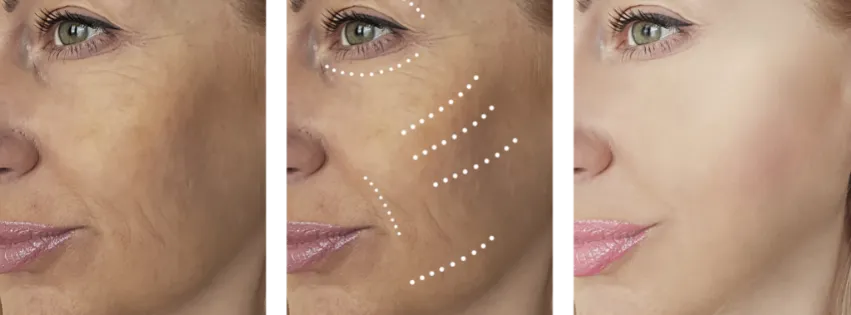 Unveiling the Truth: Symptoms and Causes of Premature Aging