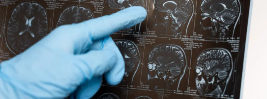 Understanding Memory Loss and Dementia: Exploring Symptoms and Causes