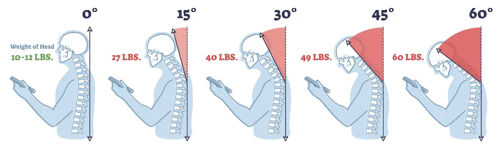 What Are The Signs Of A Tech Neck?