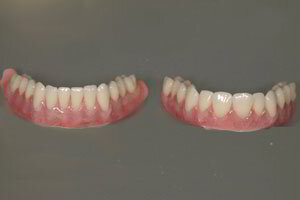 Full Dentures Designed and Fitted