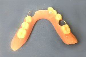 Acrylic Dentures | Southside Denture Clinic
