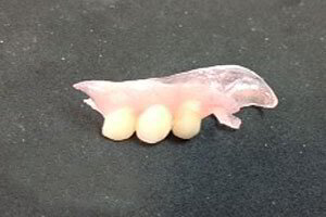Flexible Dentures | Southside Denture Clinic
