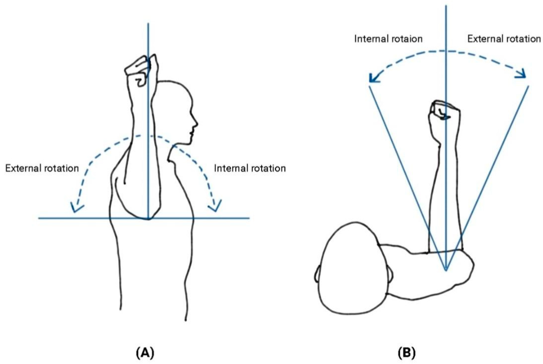 Understanding Shoulder Mechanics: The Key to Pain-Free Pressing