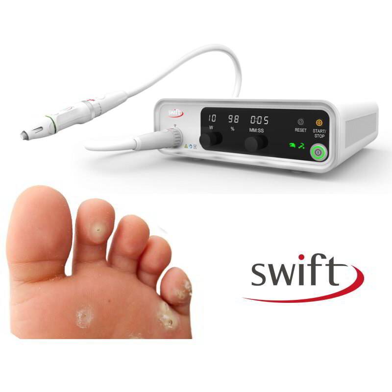 Swift Verrucae & Wart Treatment