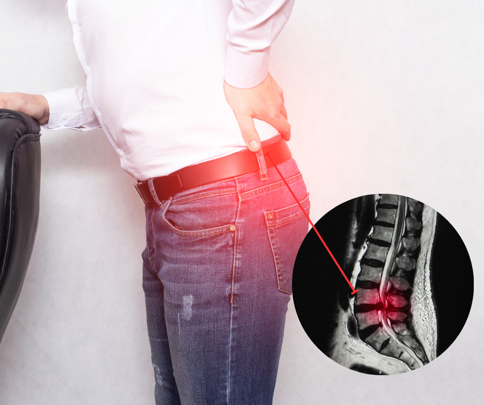 A Comprehensive Guide to Understanding Sciatica, Diagnosing, and Treating!