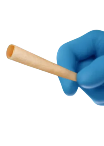 Biologic Grafts