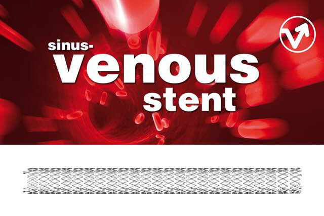 Venous Stents