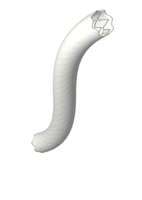 Stent Grafts