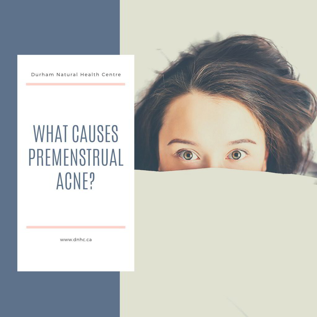 PREMENSTRUAL ACNE: WHY DO I GET IT & HOW DO I FIX IT?