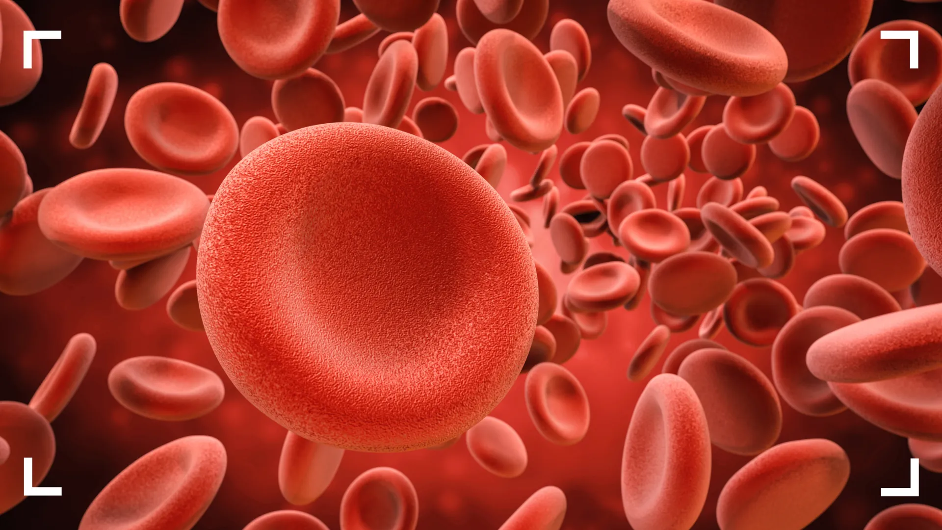 Understanding Iron Deficiency: A Patient's Guide