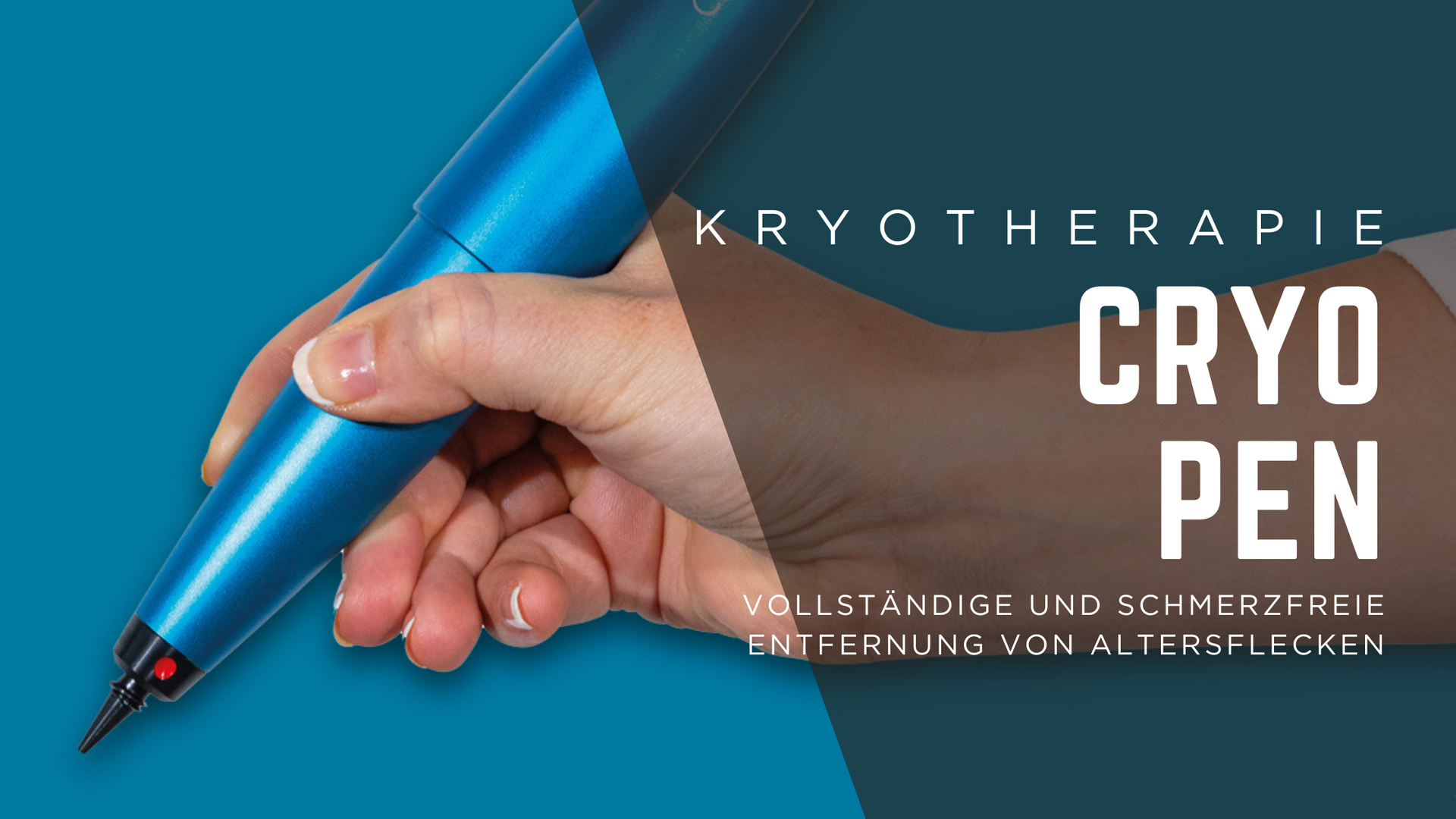 Makellose Haut: Pigmentflecken sicher entfernen mit dem Cryo Pen