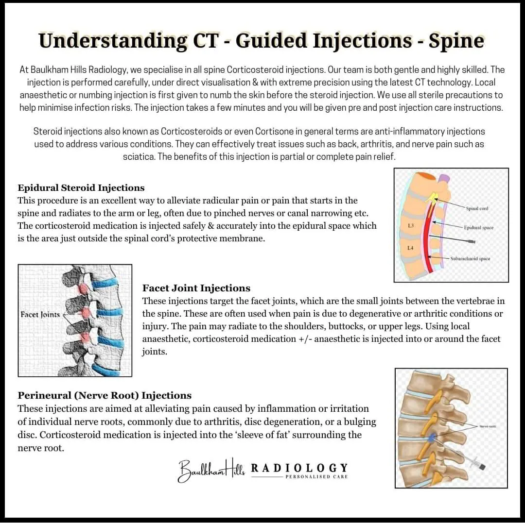 Understanding CT-Guided Injections – Spine | Baulkham Hills Radiology ...
