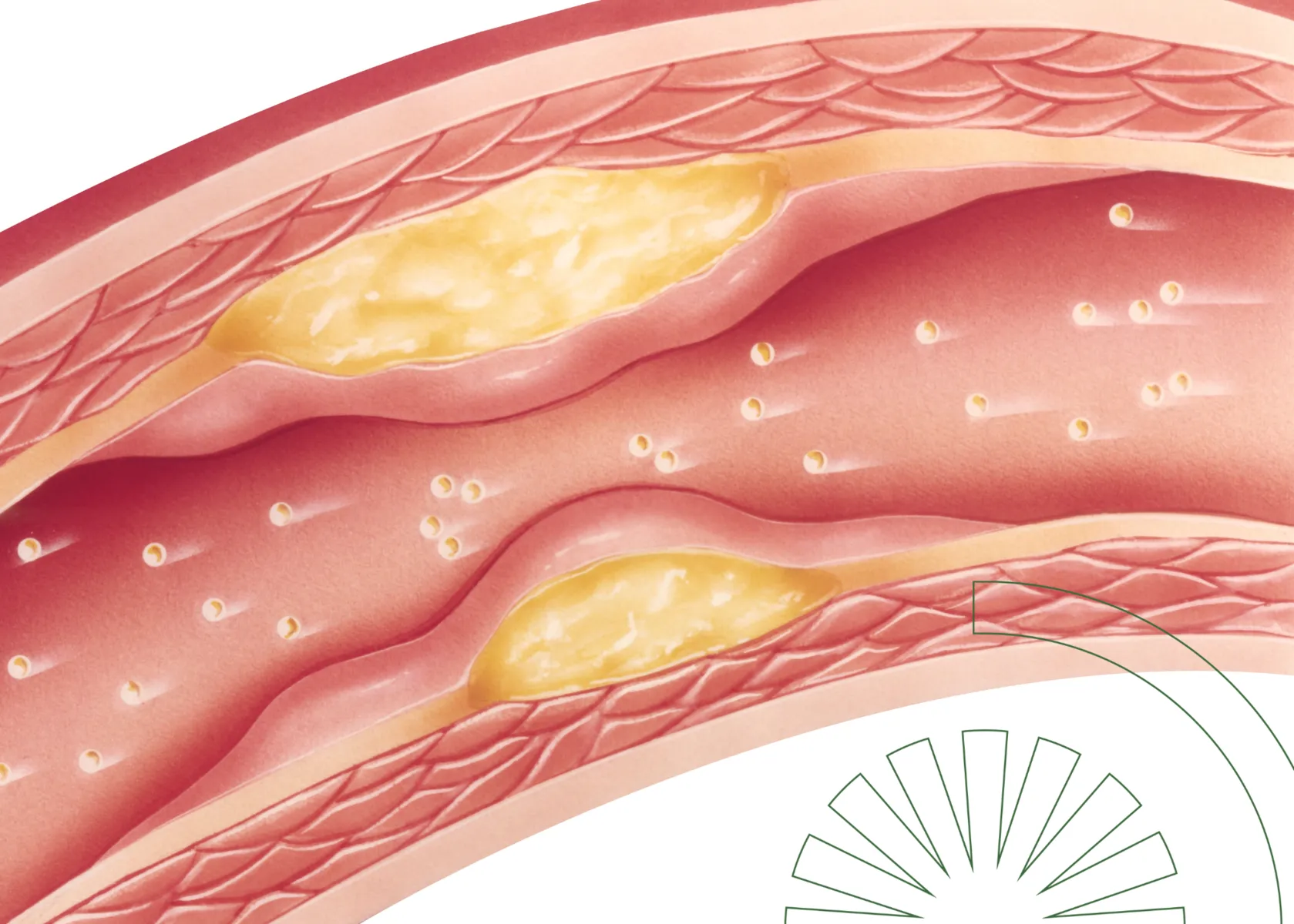 The Truth About Cholesterol