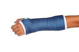 How Massage Therapy Helps After Cast Removal for a Broken Bone