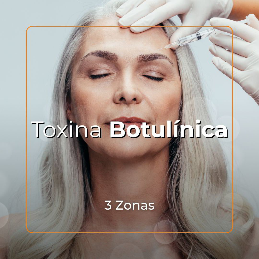 Botox Facial | Suaviza Arrugas en Frente, Entrecejo y Patas de Gallo