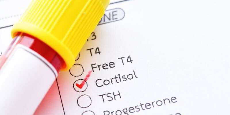 Hormone Testing: what, when and how