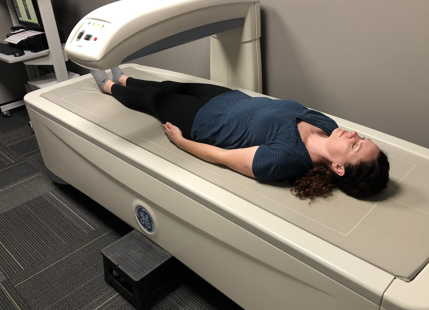 DEXA Body Composition Analysis incredible Scan 80