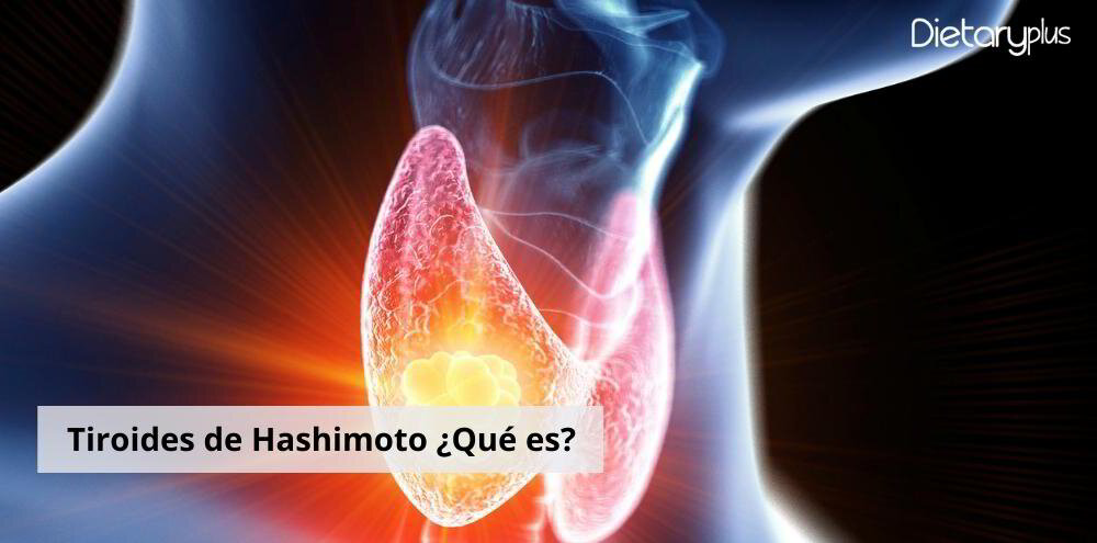 Tiroides de Hashimoto ¿Qué es?