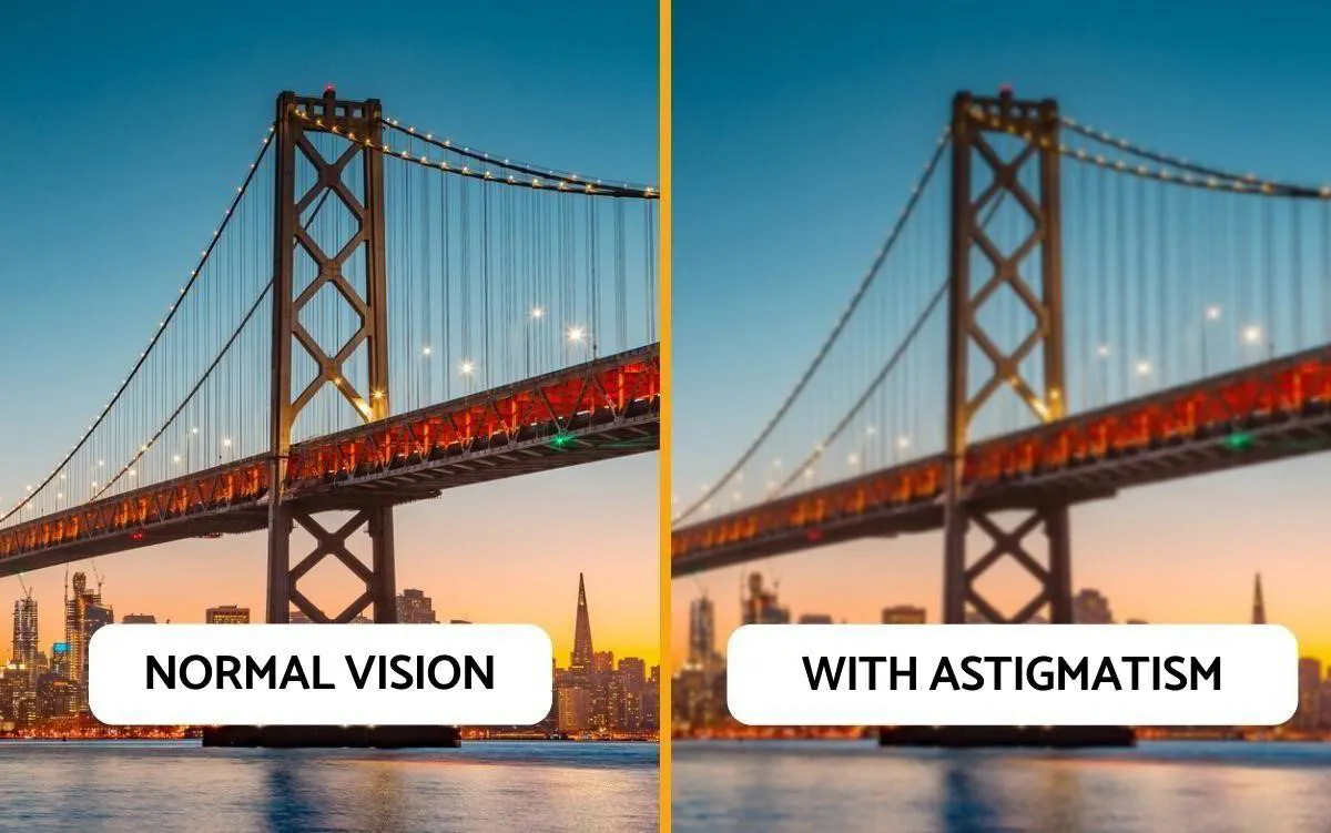 Ce este Astigmatismul?