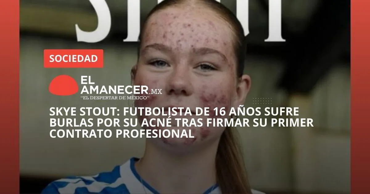Skye Stout: futbolista de 16 años sufre burlas por su acné tras firmar ...