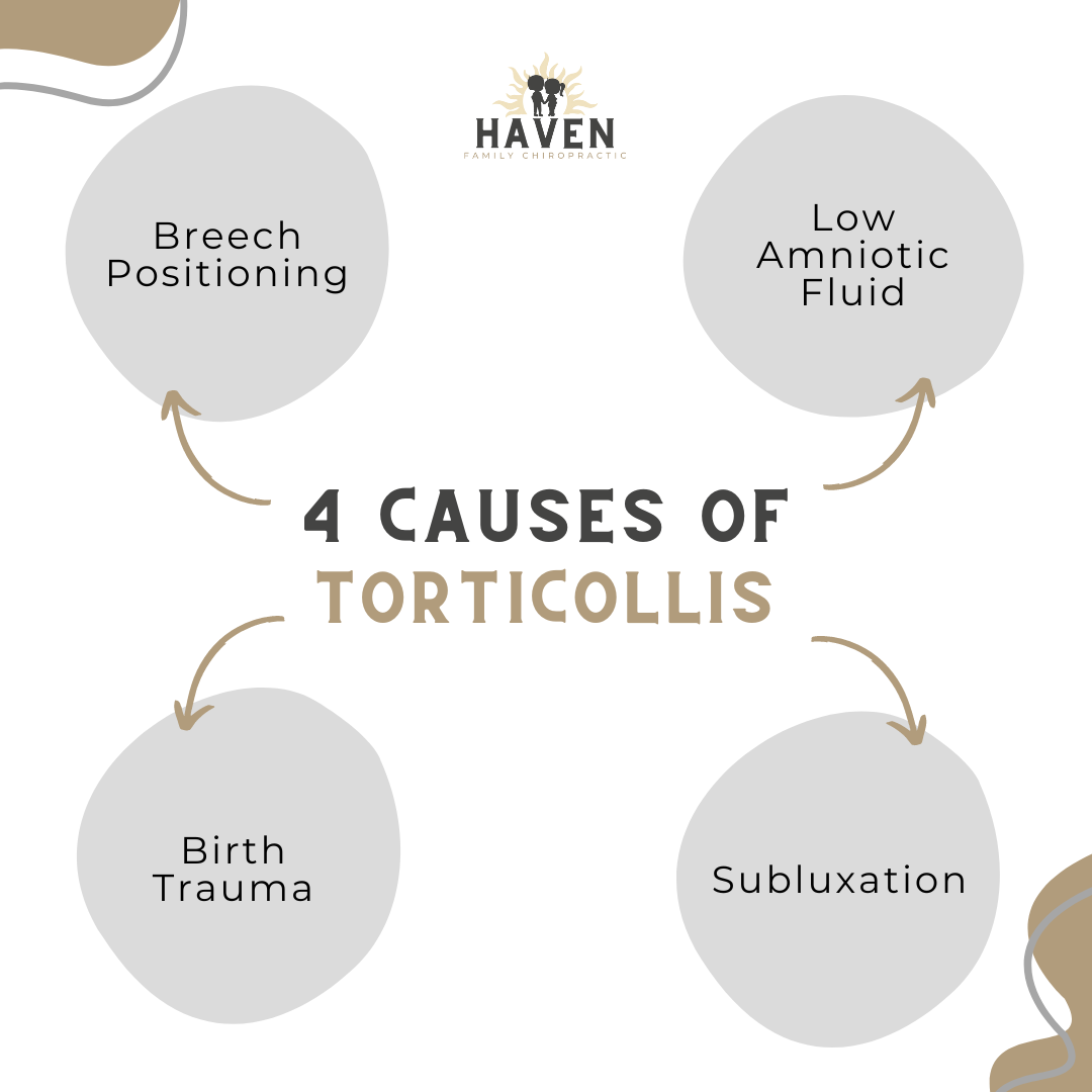 Unlocking Torticollis: INSiGHT Scans and Chiropractic