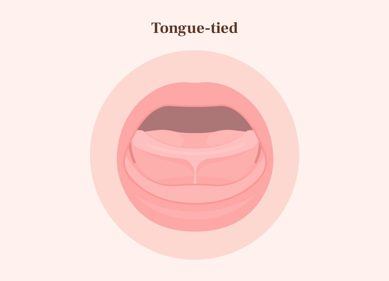 Your Baby’s Tongue Tie