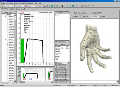 Electrodermal Screening: Tuning into Your Body’s Energy for Better Health