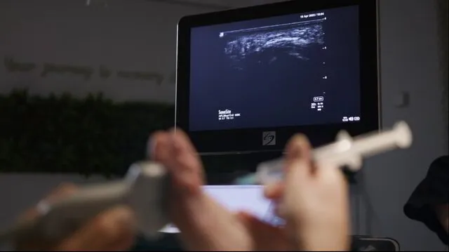 Radiological Ultrasound - Camberwell Road Podiatry Practice