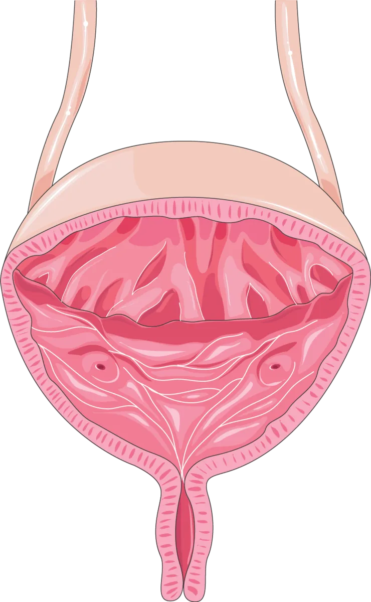 AidPlan Bladder Pain Syndrome Treatment