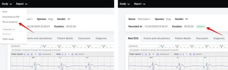 Baseline Comparison - See What’s Changed
