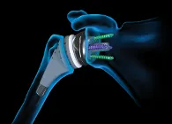 Arthrex Portland| Medical Device Solutions for Oregon & Southern Washington