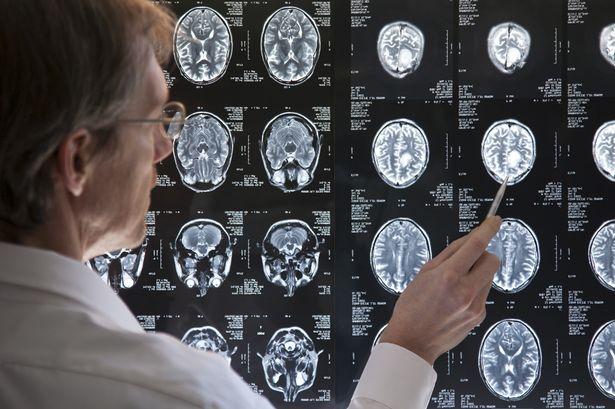 Welcome to Dr. Baljinder's Website | Neurologic care in Lockport NY