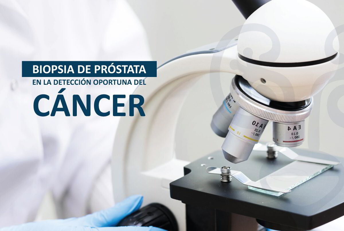 ¿CUÁNDO SE DEBE REALIZAR UNA BIOPSIA DE PRÓSTATA?