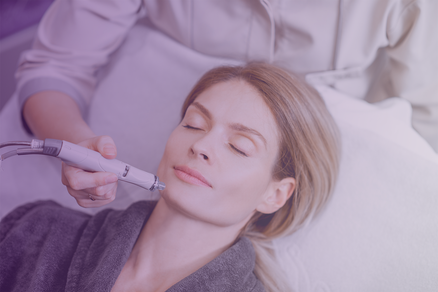 Peeling Skinova Depilación Med-Spa