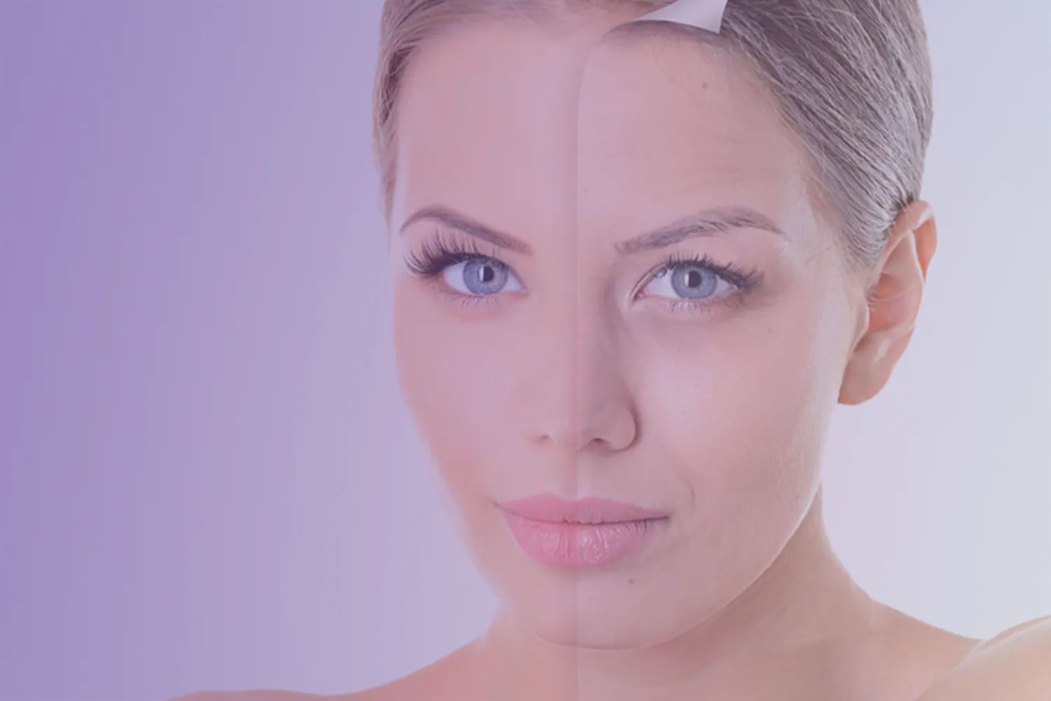 Foto Rejuvenecimiento facial en Skinova Depilación Med y Spa en Nuevo ...