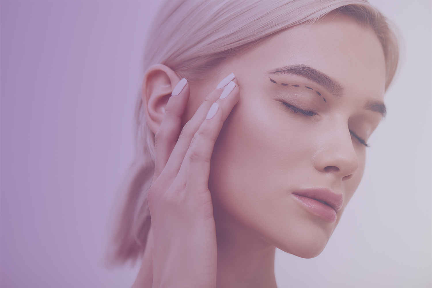 Lifting de ojos sin cirugía Skinova Depilación Med-Spa