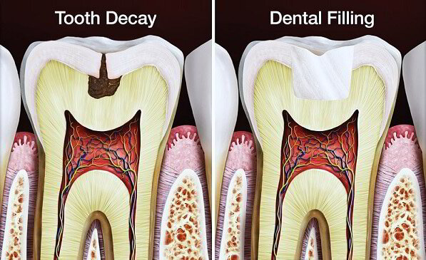 Restorative dentistry