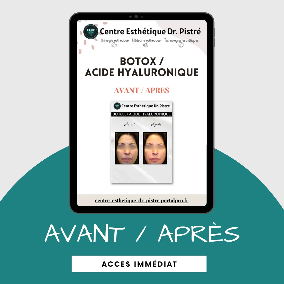 Découvrez nos photos Avant Après Injection Botox - Acide Hyaluronique