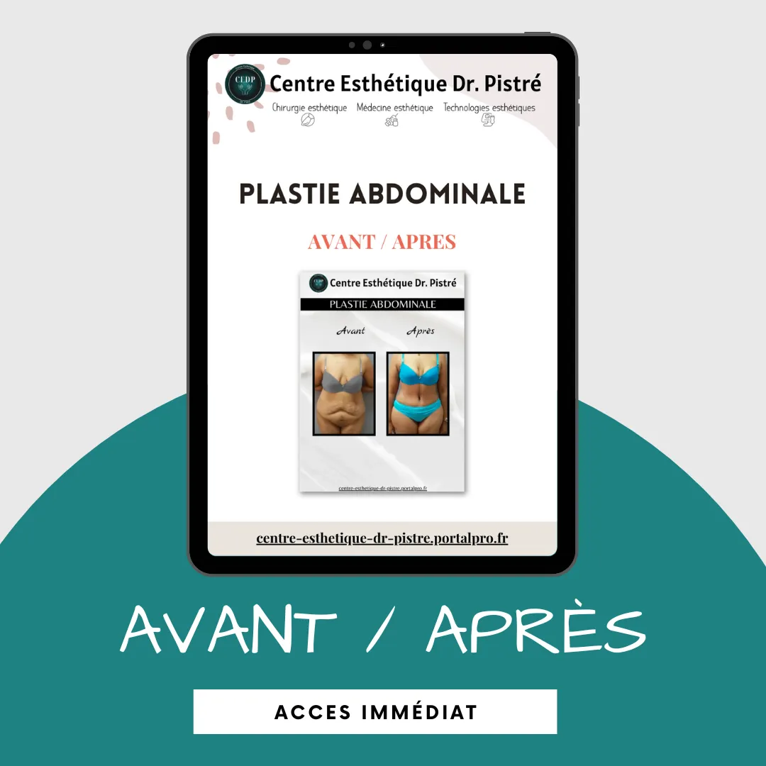 Découvrez nos photos Avant Après Plastie Abdominale