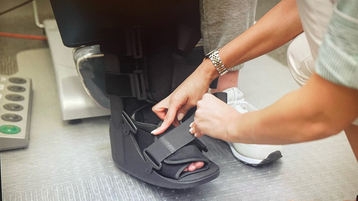 Cam Walkers/Moon boots or Post op-boots - Boroondara Podiatry Centre