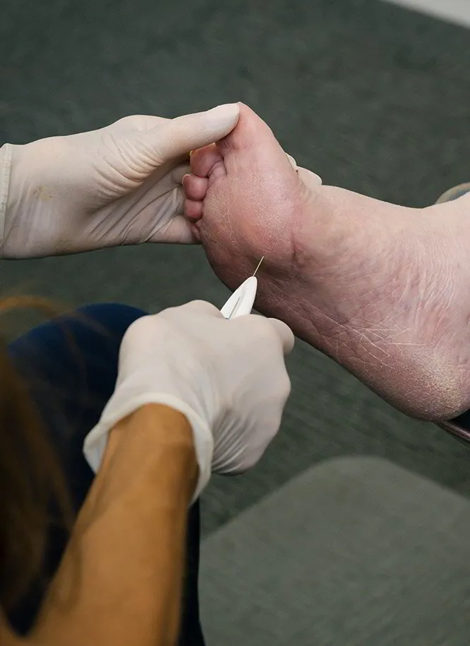 Diabetes Foot Assessments