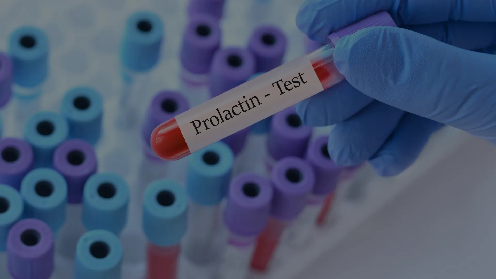 Prolactin And Why You Need To Check It For Fertility